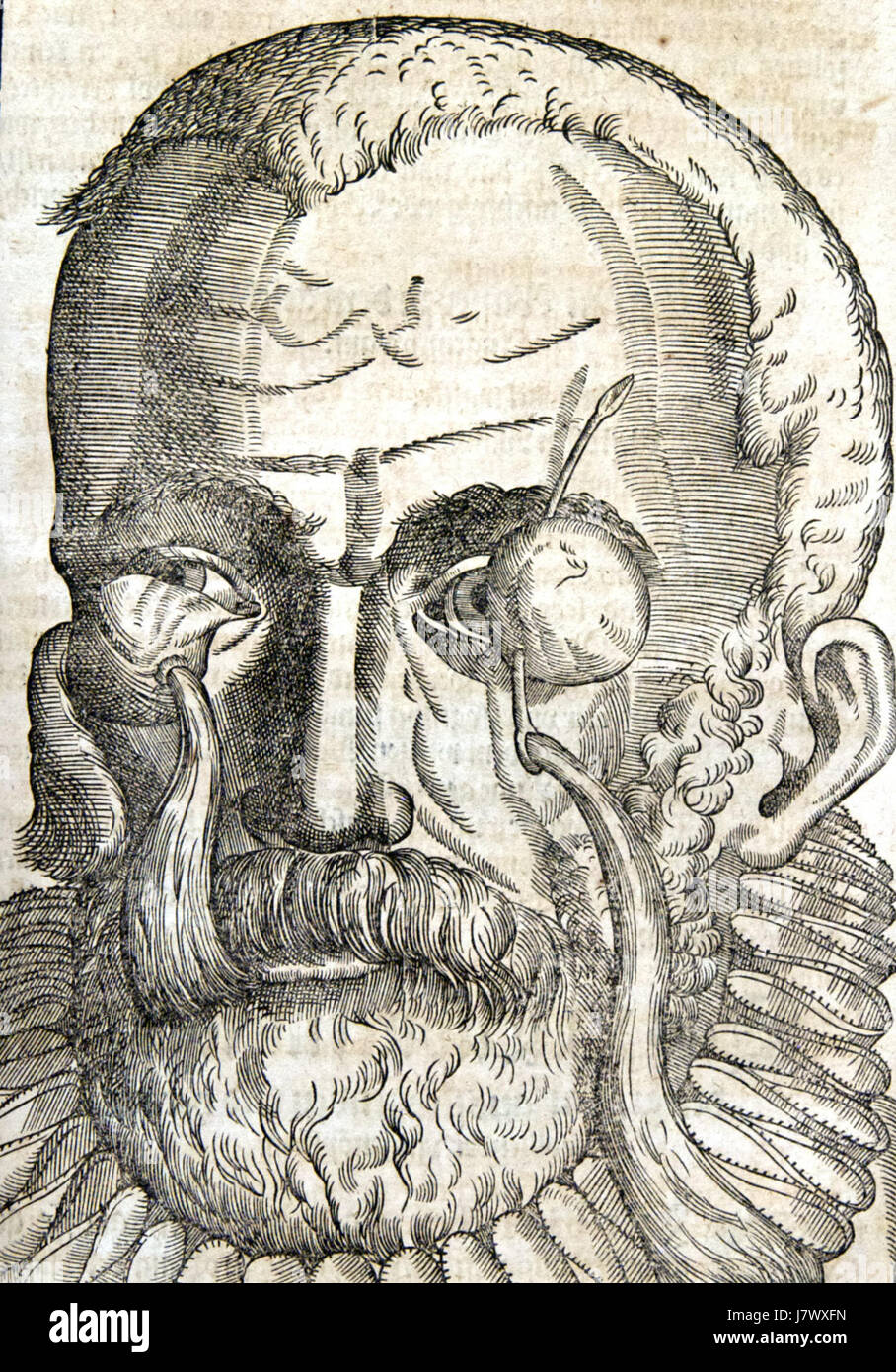 Bartischâ€™s 16th-century work on ocular diseases provides a detailed ...