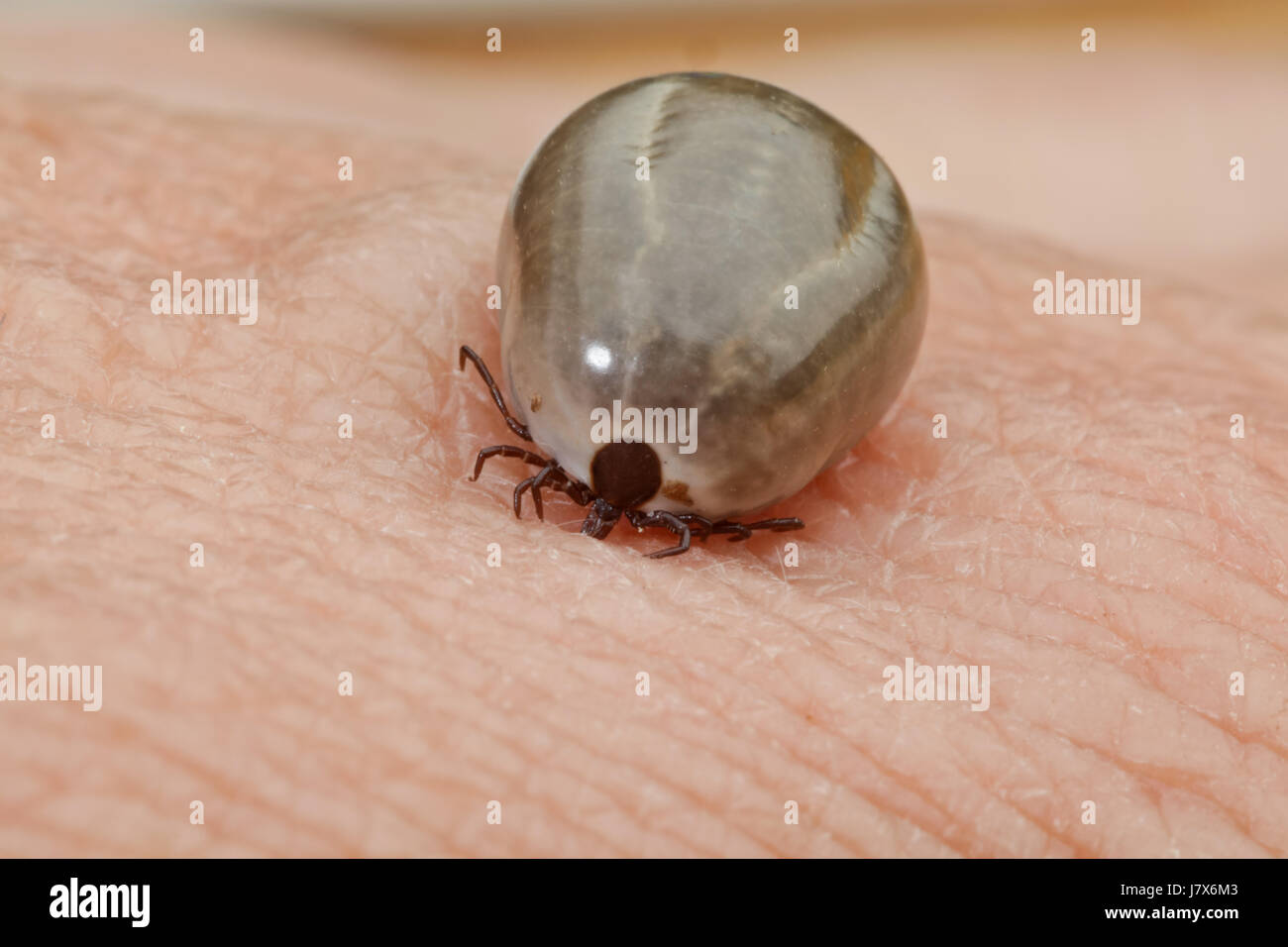 skin tick bite hand insect skin pain injury blood-sucker tick tic ...