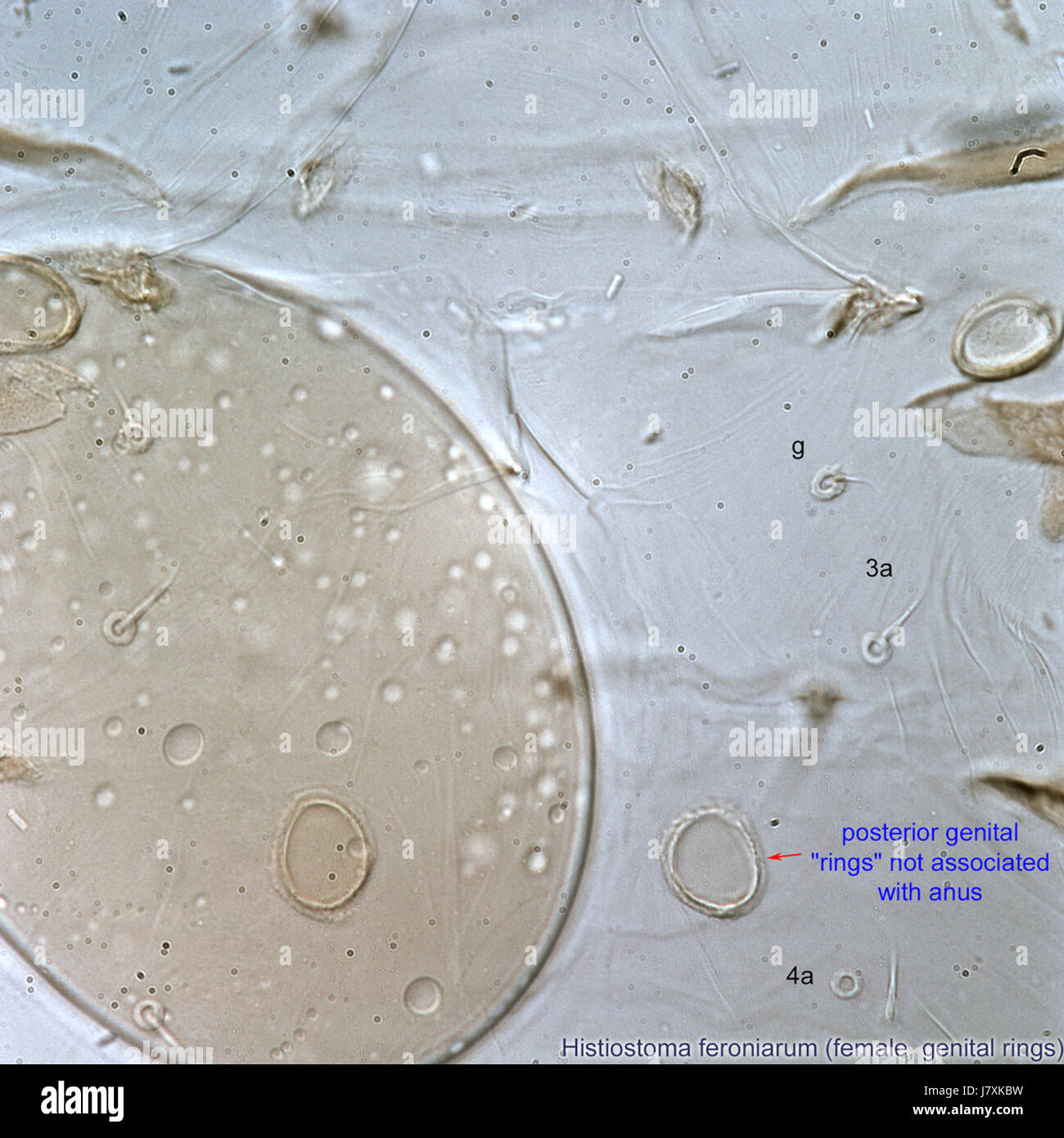 This scientific image focuses on the female genital rings of ...