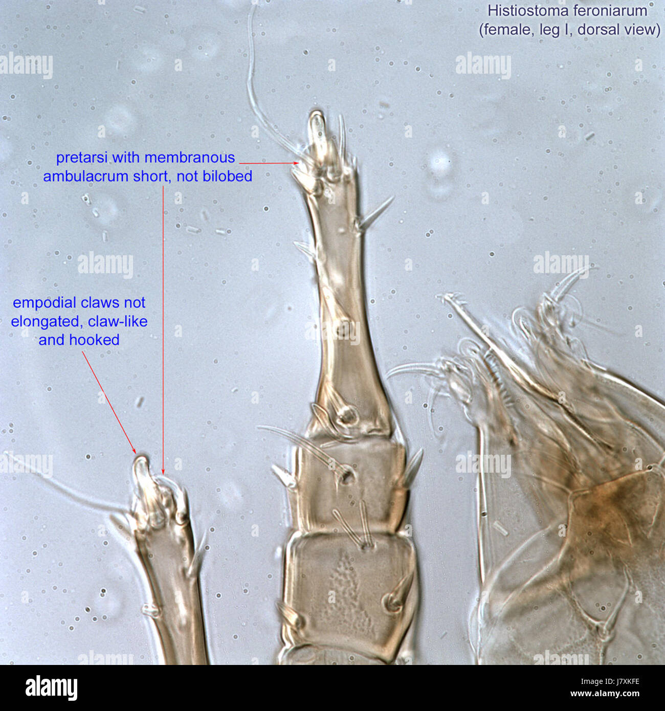 This image shows a detailed dorsal view of a female Histiostoma ...