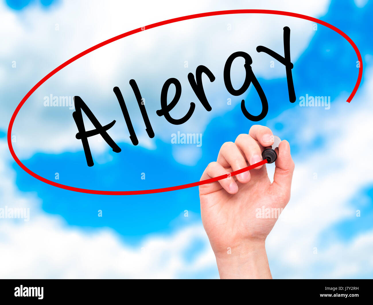 Man Hand writing Allergy with marker on transparent wipe board ...