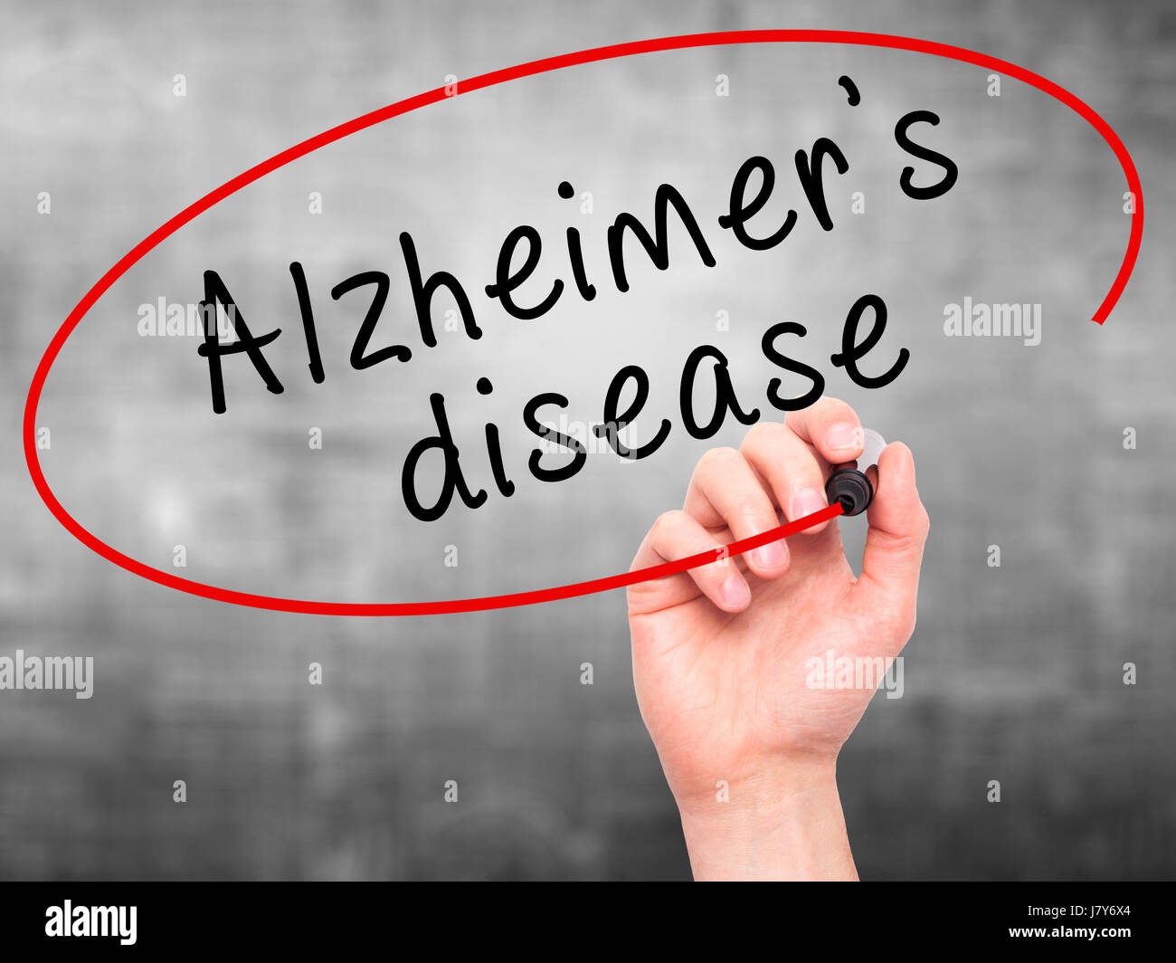 Man Hand writing Alzheimer's disease with black marker on visual screen ...
