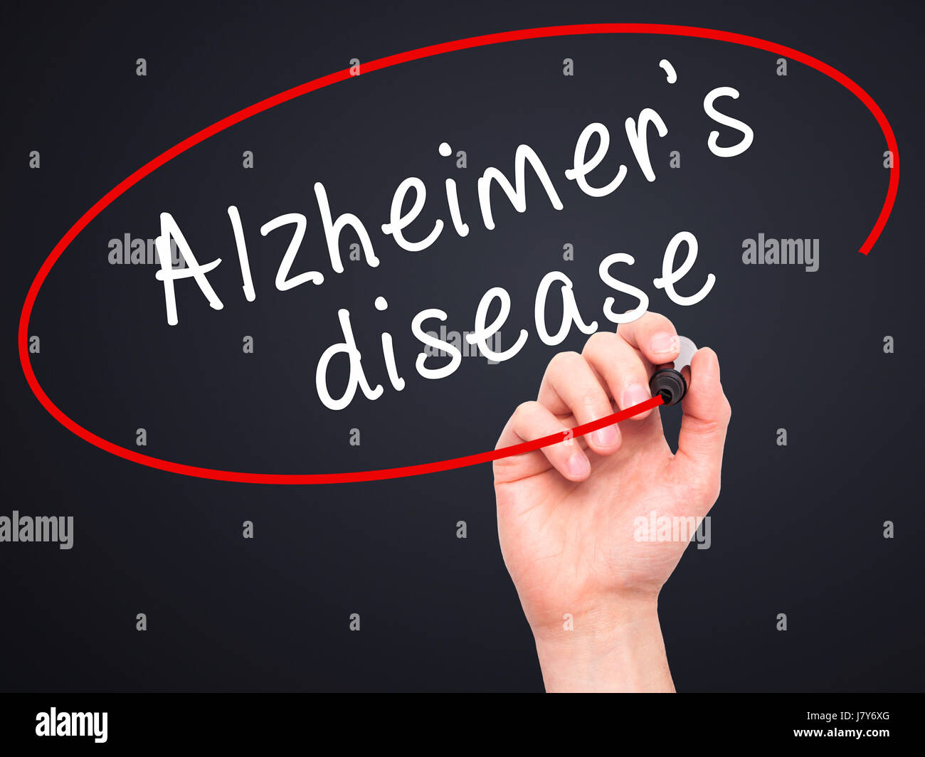 Man Hand writing Alzheimer's disease with black marker on visual screen ...