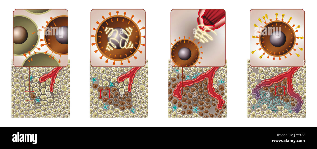 science illustration cell cancer attack means agent medicine drug ...