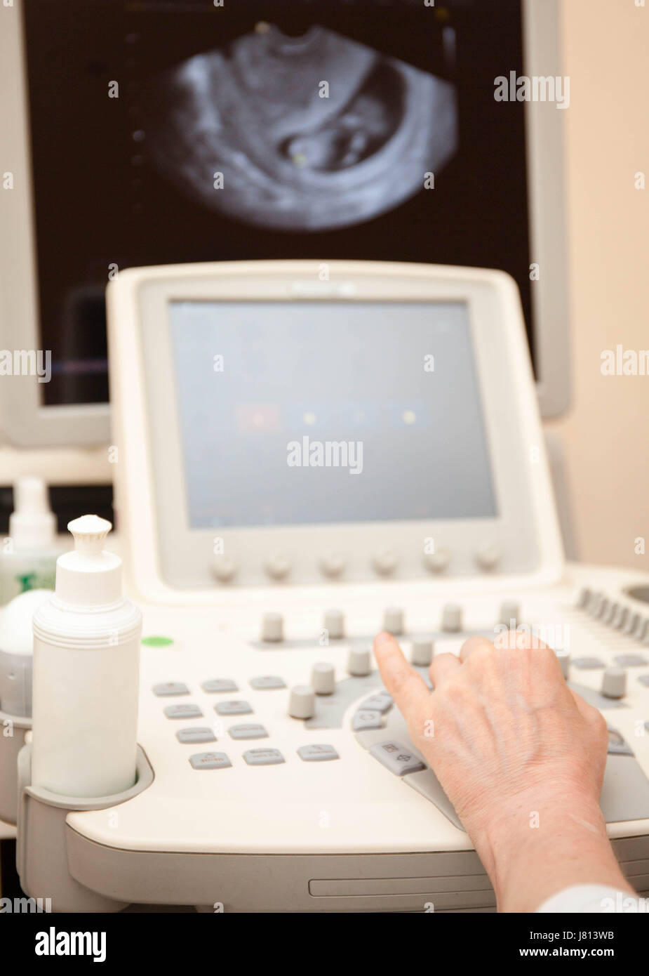 Echocardiography ultrasound hi-res stock photography and images - Alamy