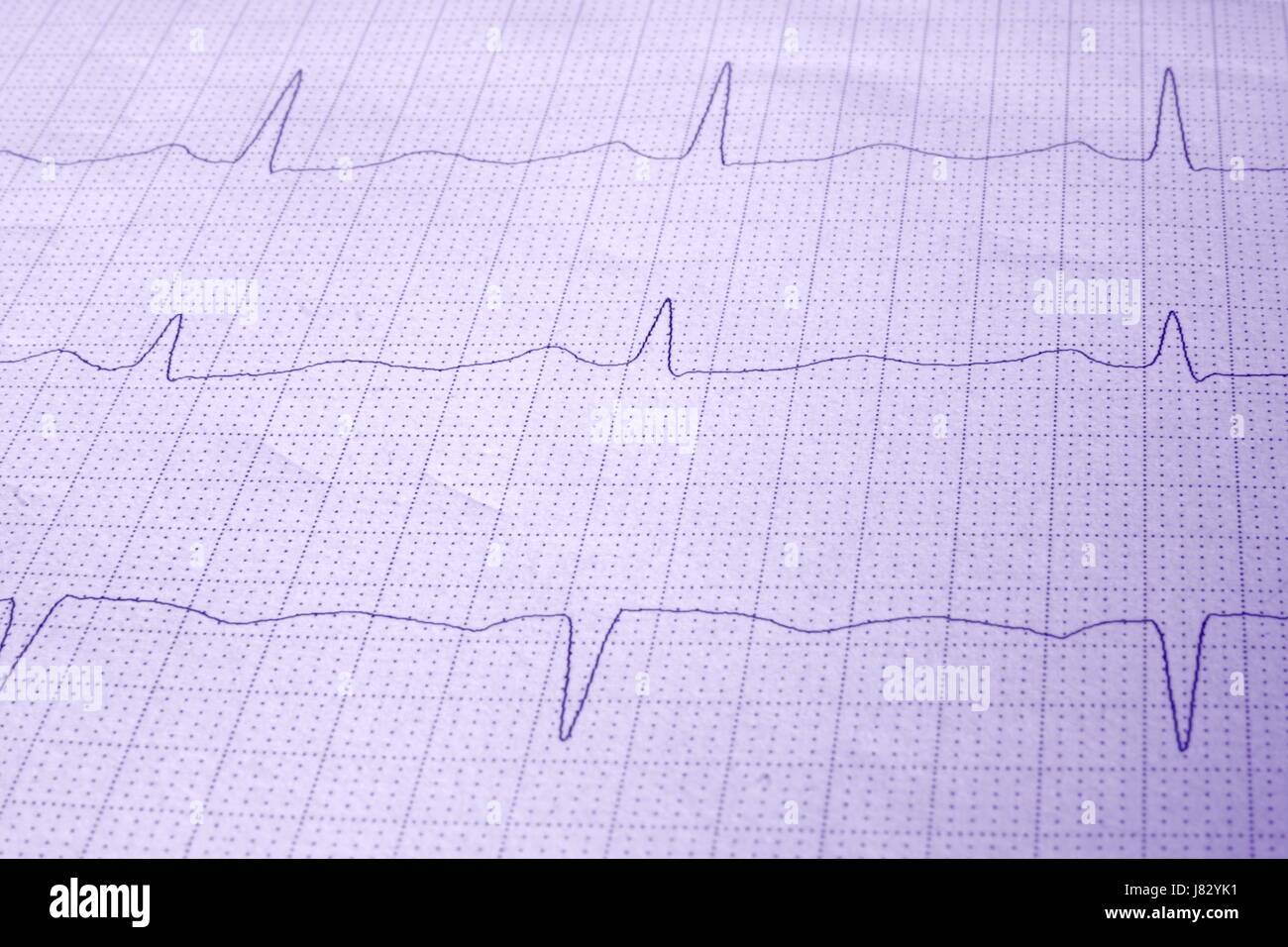 tooth diagnosis diagnostic heartbeat electrocardiogram medicine medicin ...