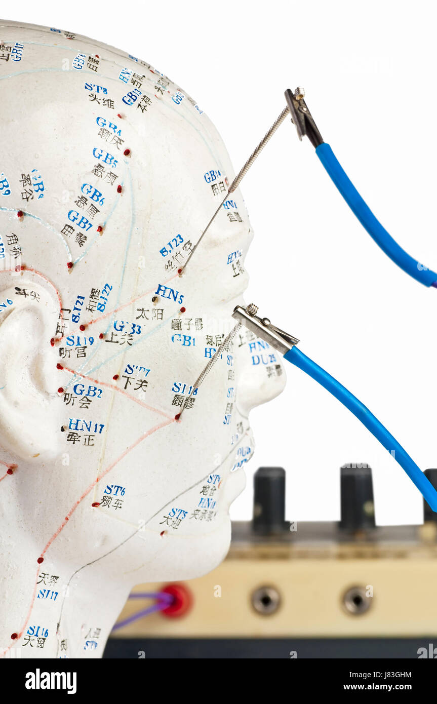 acupuncture china asia asiatic sting traditional cure chinese needles ...