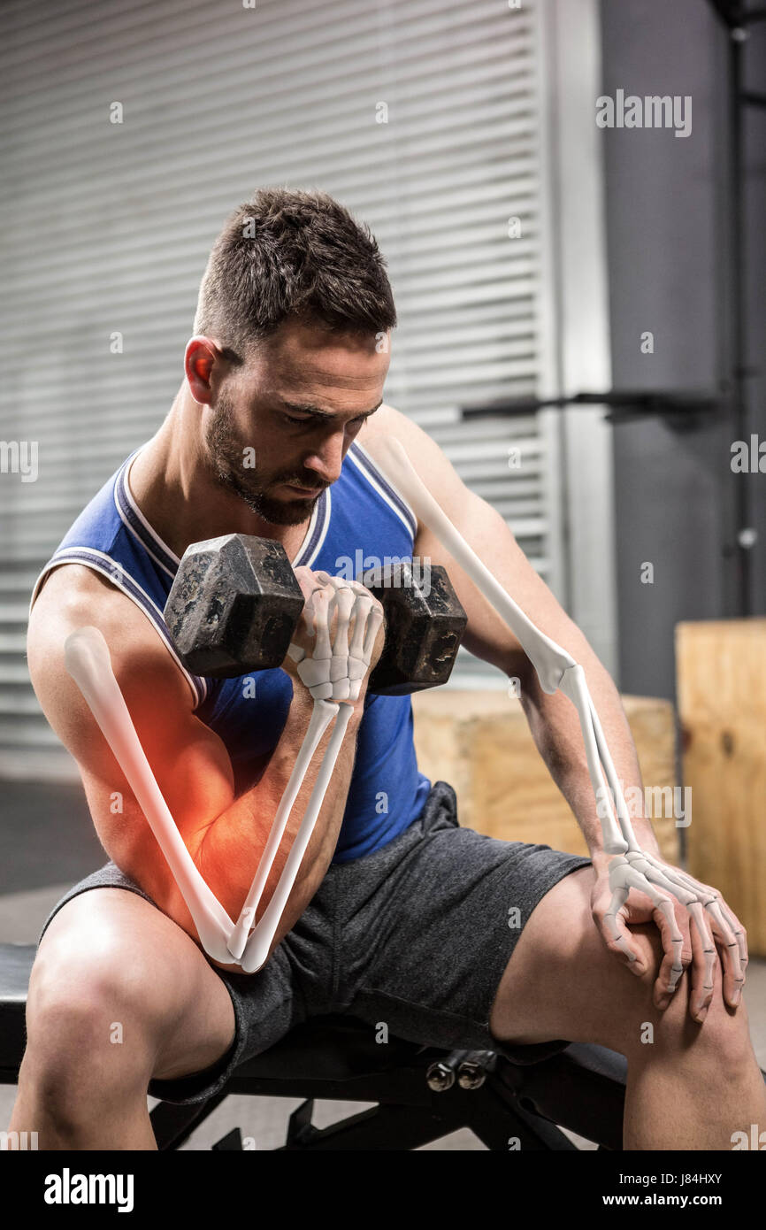 Athlete bone hi-res stock photography and images - Alamy