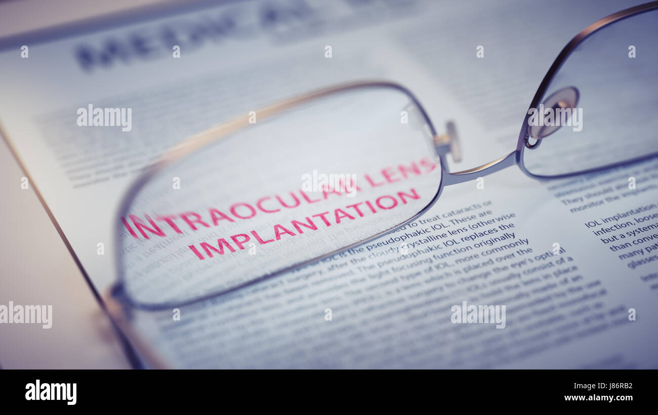 Intraocular Lens Implantation Article Title Highlighted Through ...