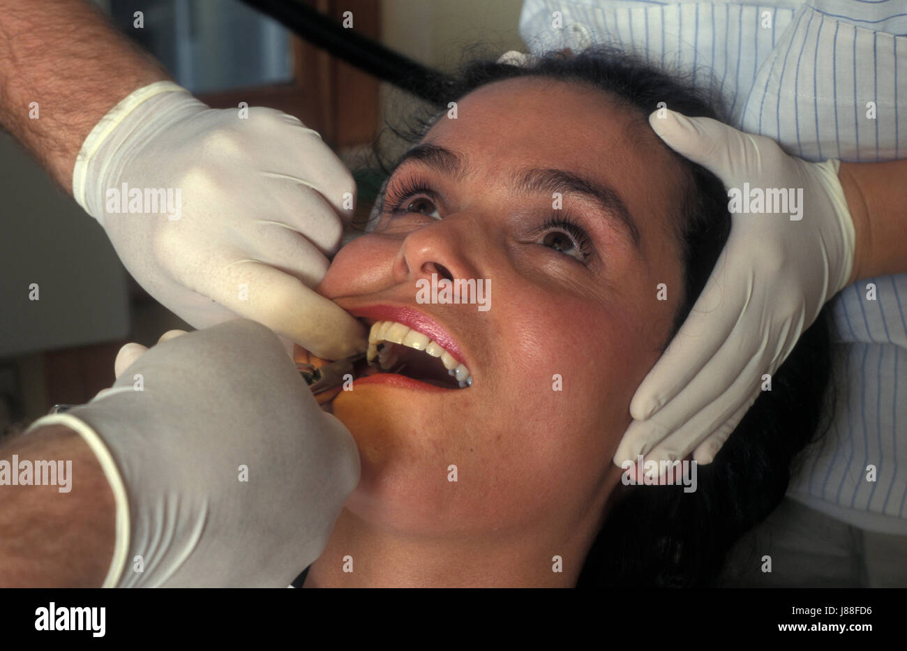 anglo-israeli woman at dentist having tooth extraction Stock Photo - Alamy