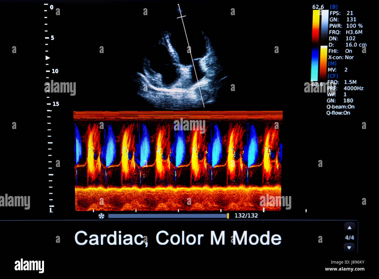 Colourful image of modern ultrasound monitor. Ultrasonography machine ...