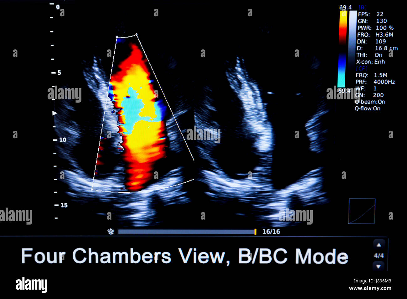 Colourful image of modern ultrasound monitor. Ultrasonography machine ...