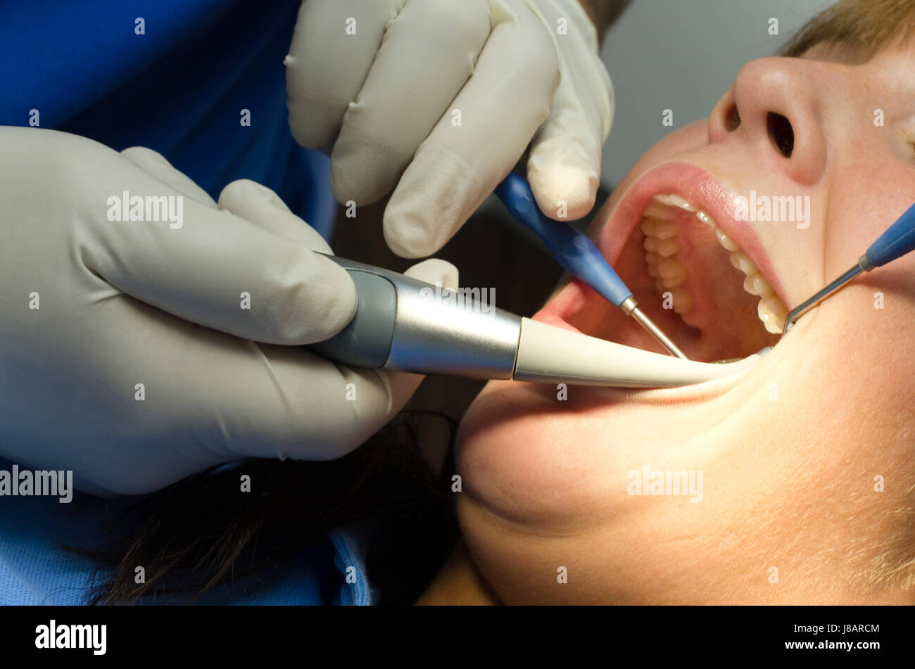 mouth, teeth, dentist, tooth, patient, treat, dental practice, medicine ...