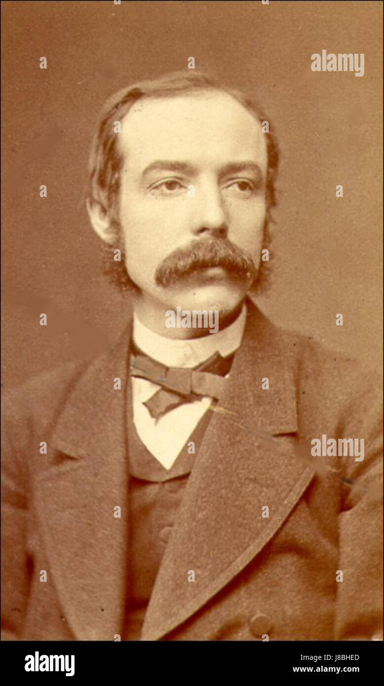 Quincke edema hi-res stock photography and images - Alamy