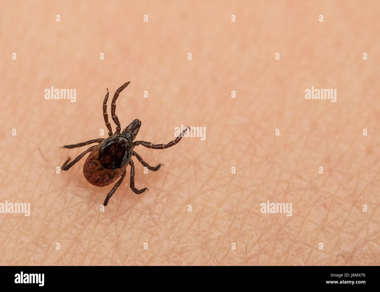 A tick can be seen close-up in Sieversdorf, Germany, 27 May 2017. Ticks ...