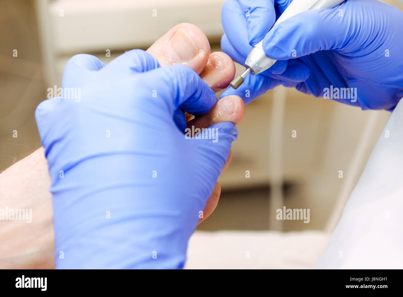 Chiropodist High Resolution Stock Photography and Images - Alamy
