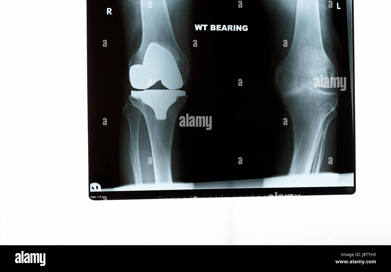 medicinally, medical, skeleton, means, agent, medicine, drug, remedy ...