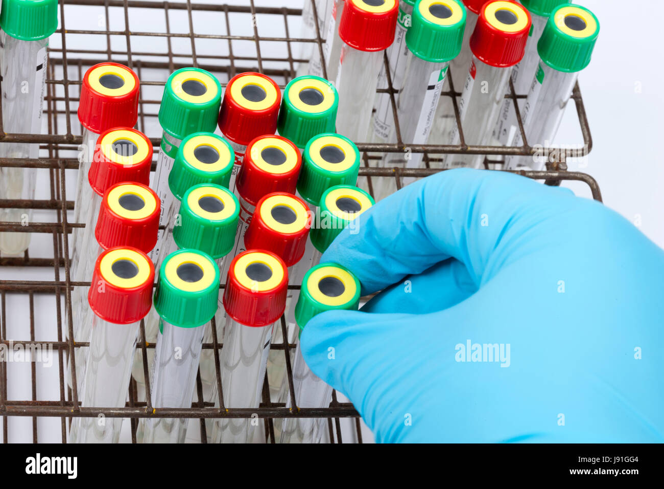 blood, grouping, row, blood, hold, tube, mark, means, agent, medicine ...