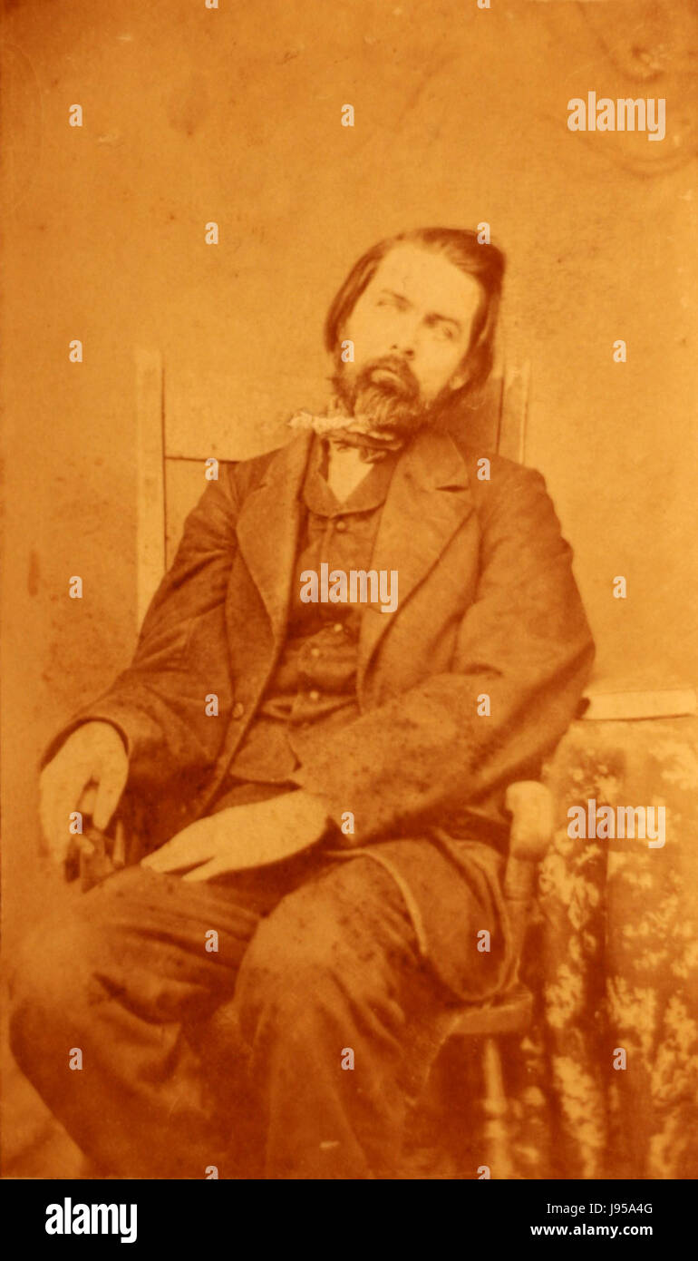 Post Mortem Ballistic