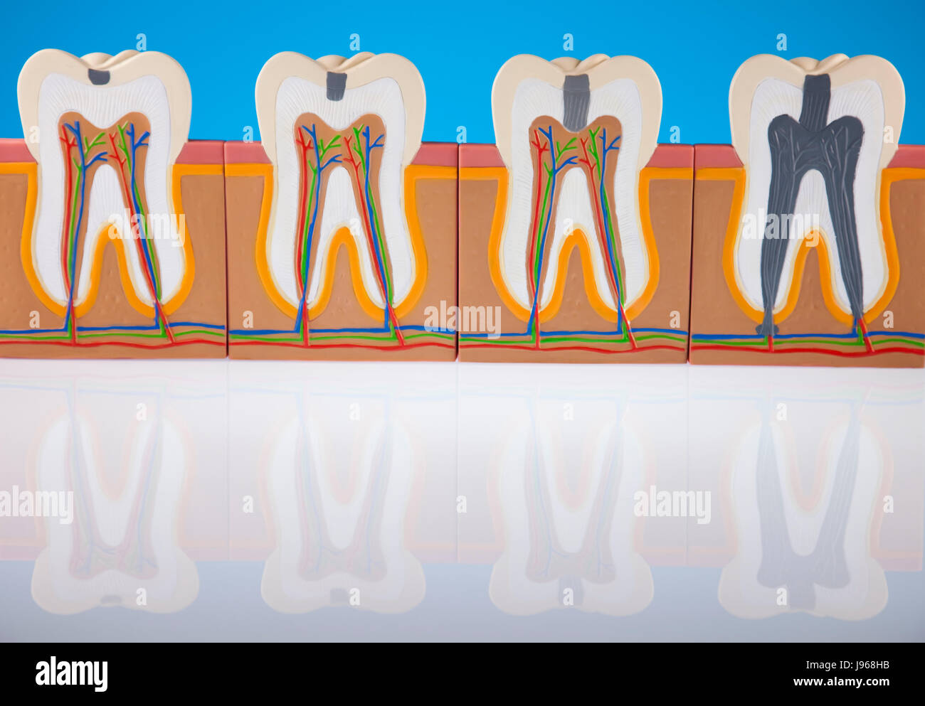 health, teeth, dentist, human, human being, tooth, dental, jagged ...