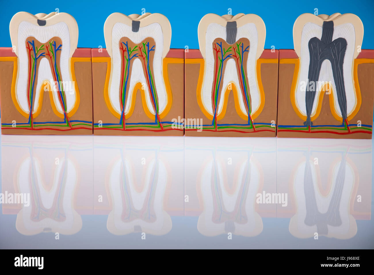 health, teeth, dentist, human, human being, tooth, dental, jagged ...