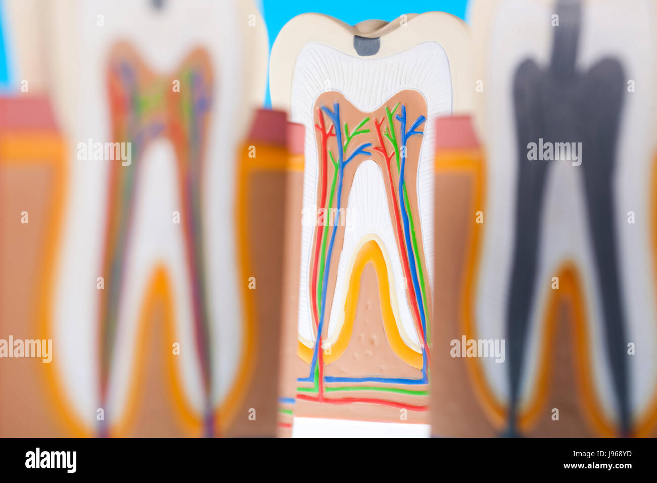 health, teeth, dentist, human, human being, tooth, dental, jagged ...