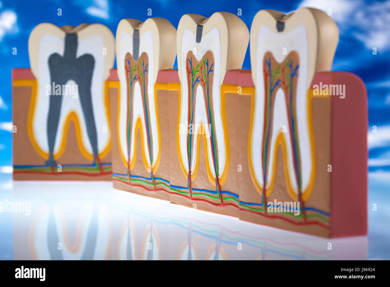 health, teeth, dentist, human, human being, tooth, dental, jagged ...