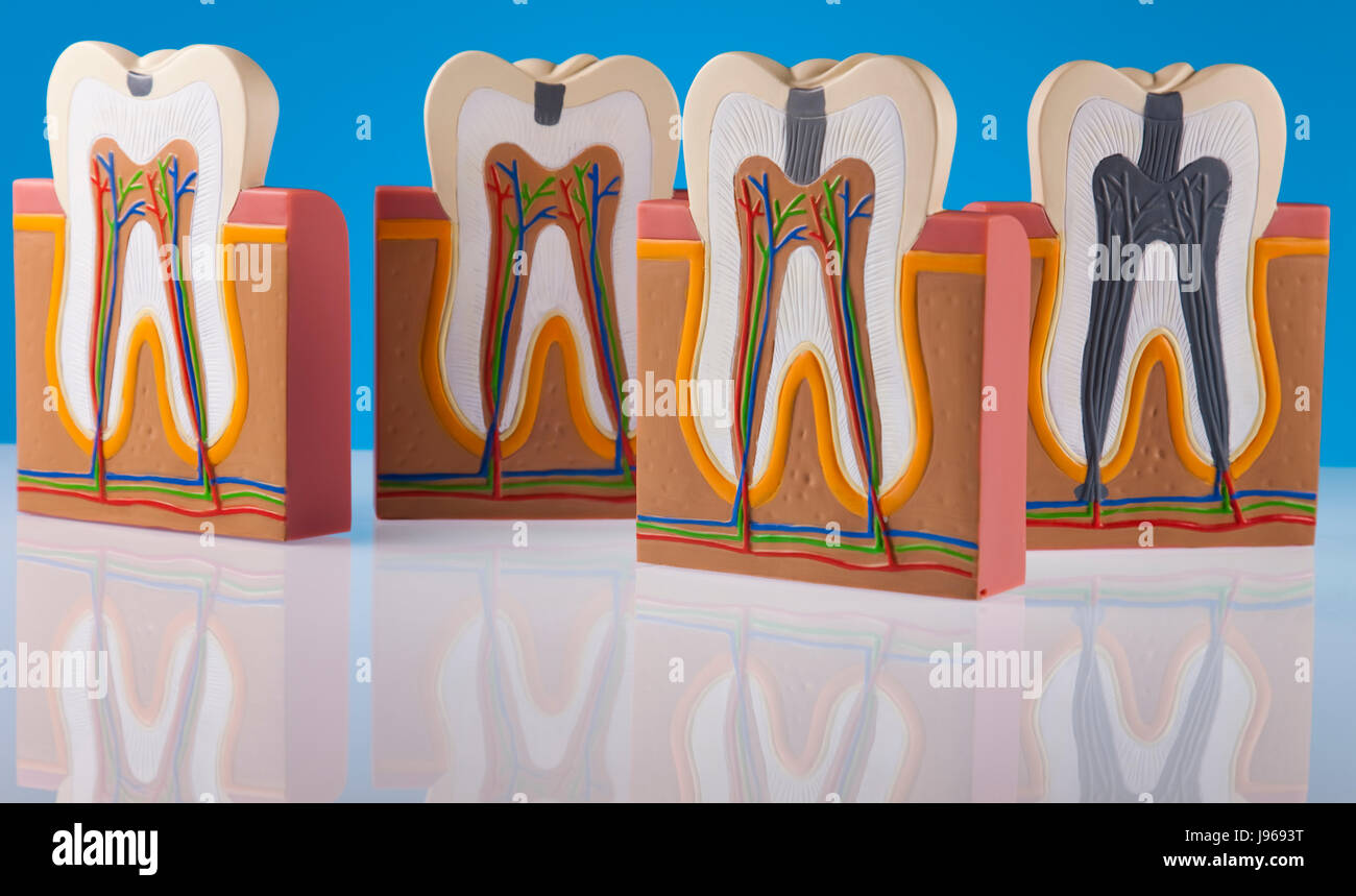 health, teeth, dentist, human, human being, tooth, dental, jagged ...