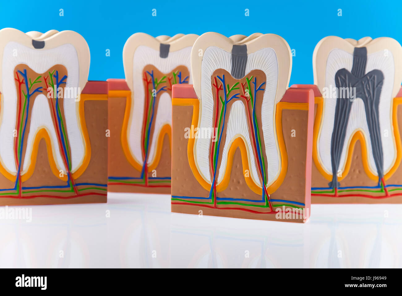 health, teeth, dentist, human, human being, tooth, dental, jagged ...