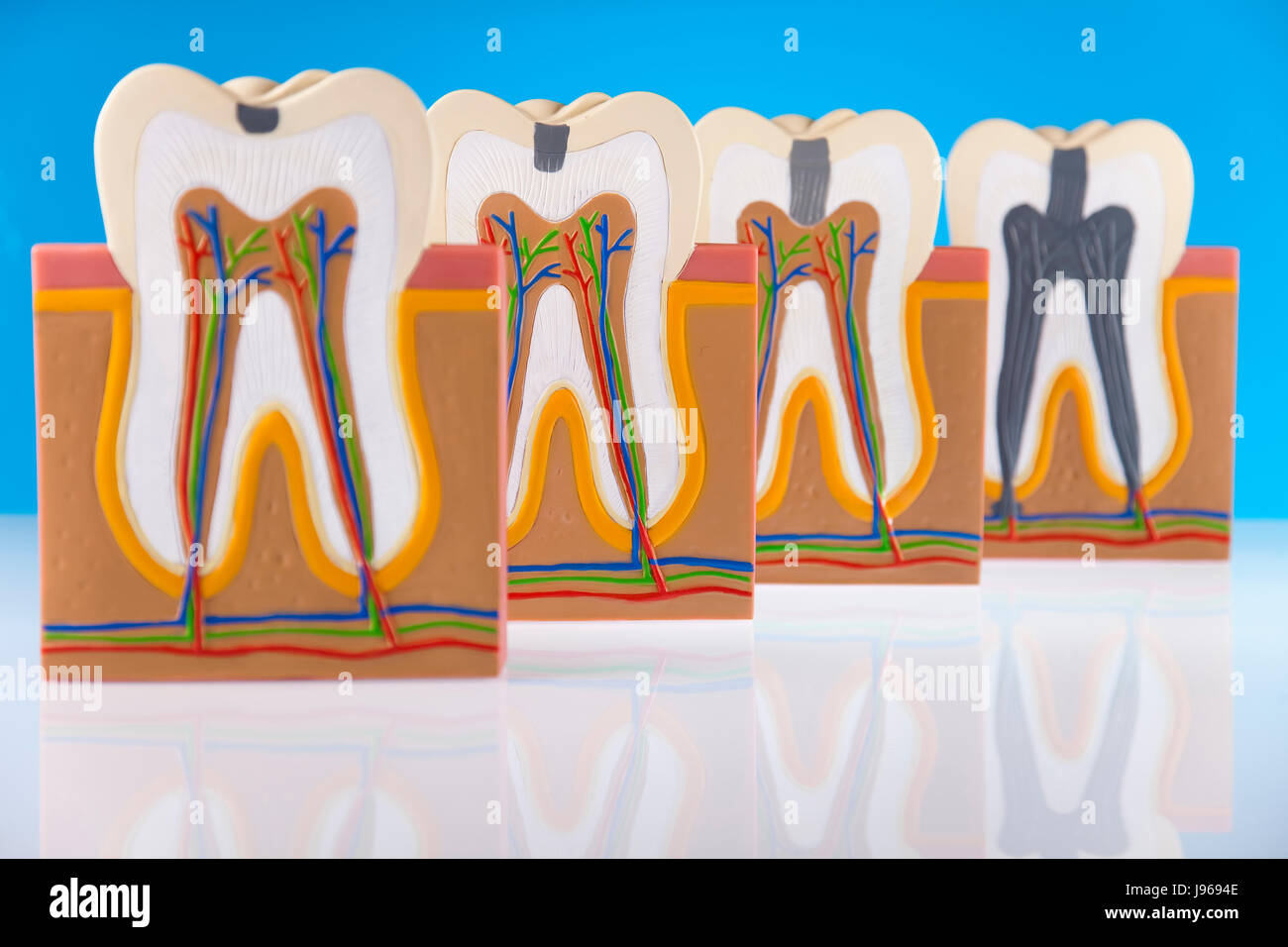 health, teeth, dentist, human, human being, tooth, dental, jagged ...