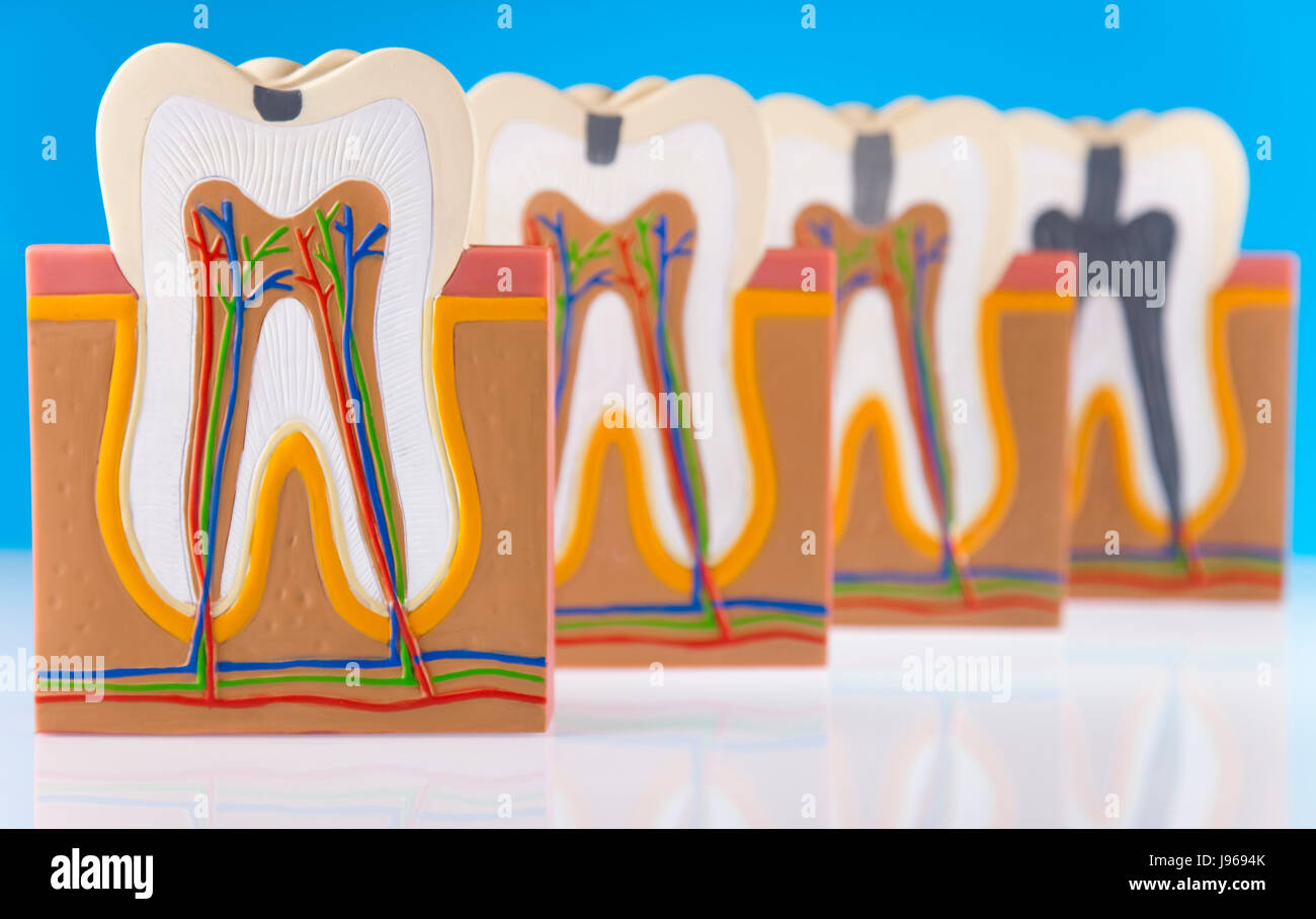 health, teeth, dentist, human, human being, tooth, dental, jagged ...