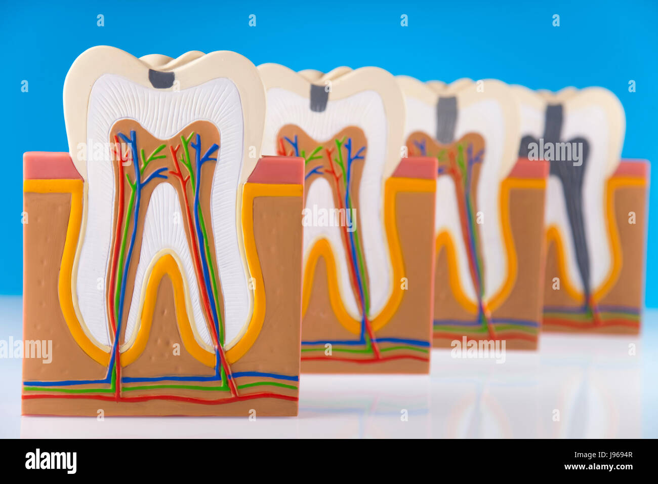 health, teeth, dentist, human, human being, tooth, dental, jagged ...