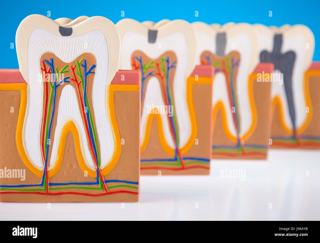 health, teeth, dentist, human, human being, tooth, dental, jagged ...