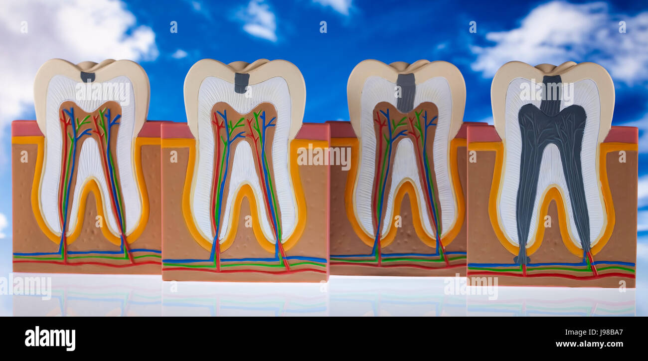 health, teeth, dentist, human, human being, tooth, dental, healthcare ...