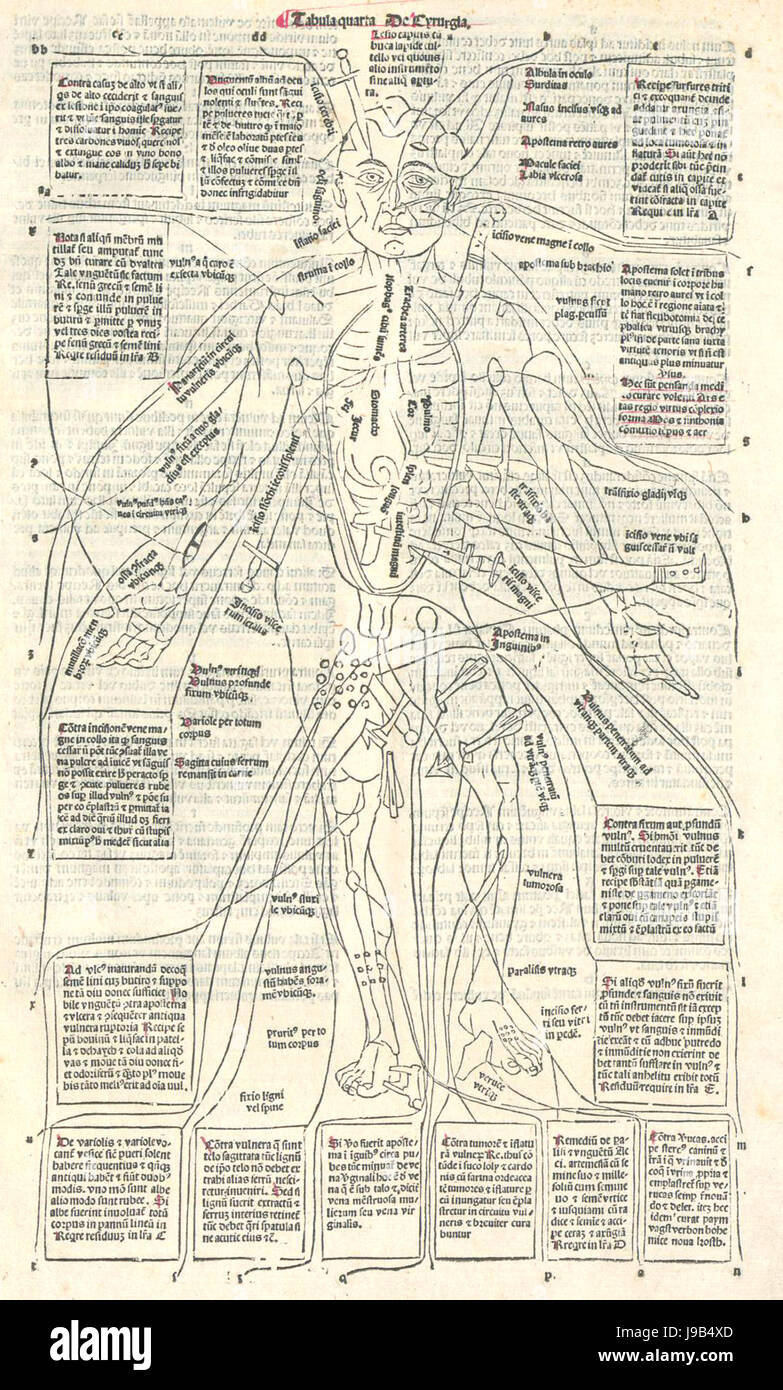 Medieval surgery, 15th century hi-res stock photography and images - Alamy