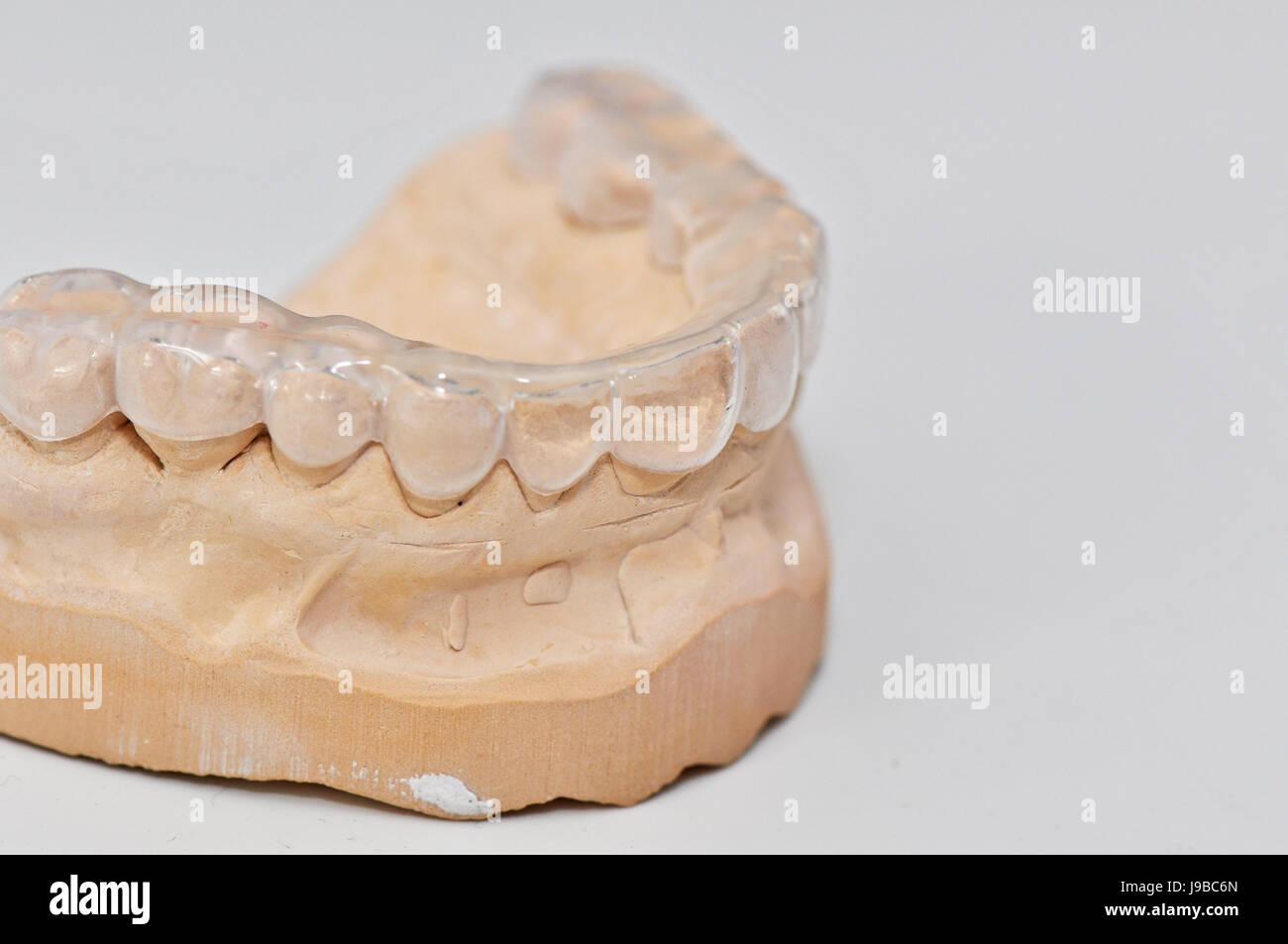 teeth, bit, plaster stone, brace, laugh, laughs, laughing, twit, giggle ...