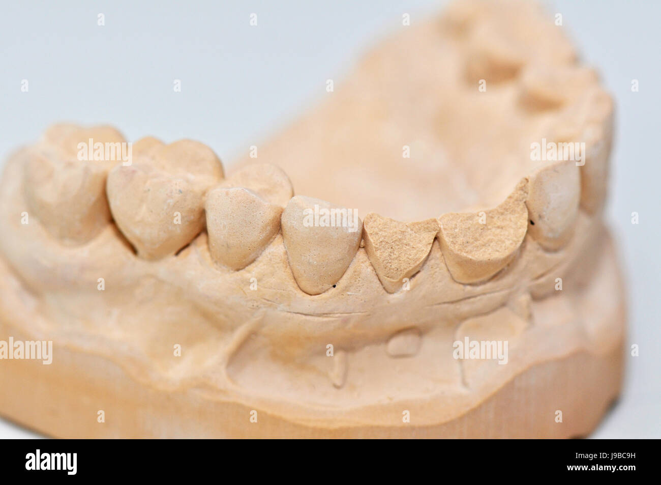 teeth, bit, plaster stone, brace, laugh, laughs, laughing, twit, giggle ...