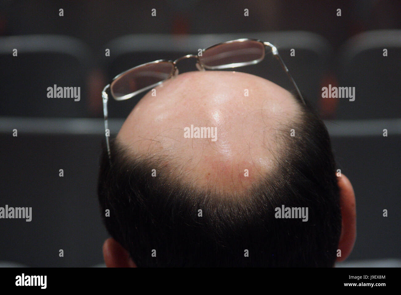 Bald head back of hi-res stock photography and images - Alamy