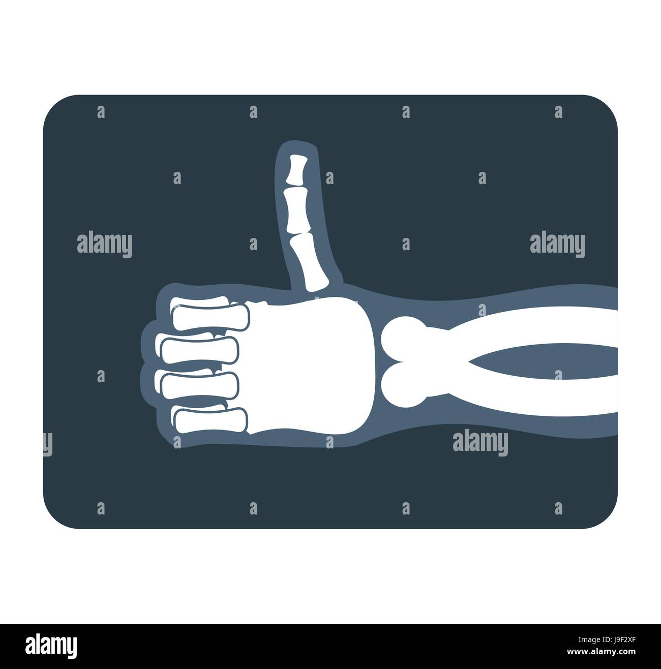 Thumbs up x-ray. Bones of hand shows all good. Medical illustration ...