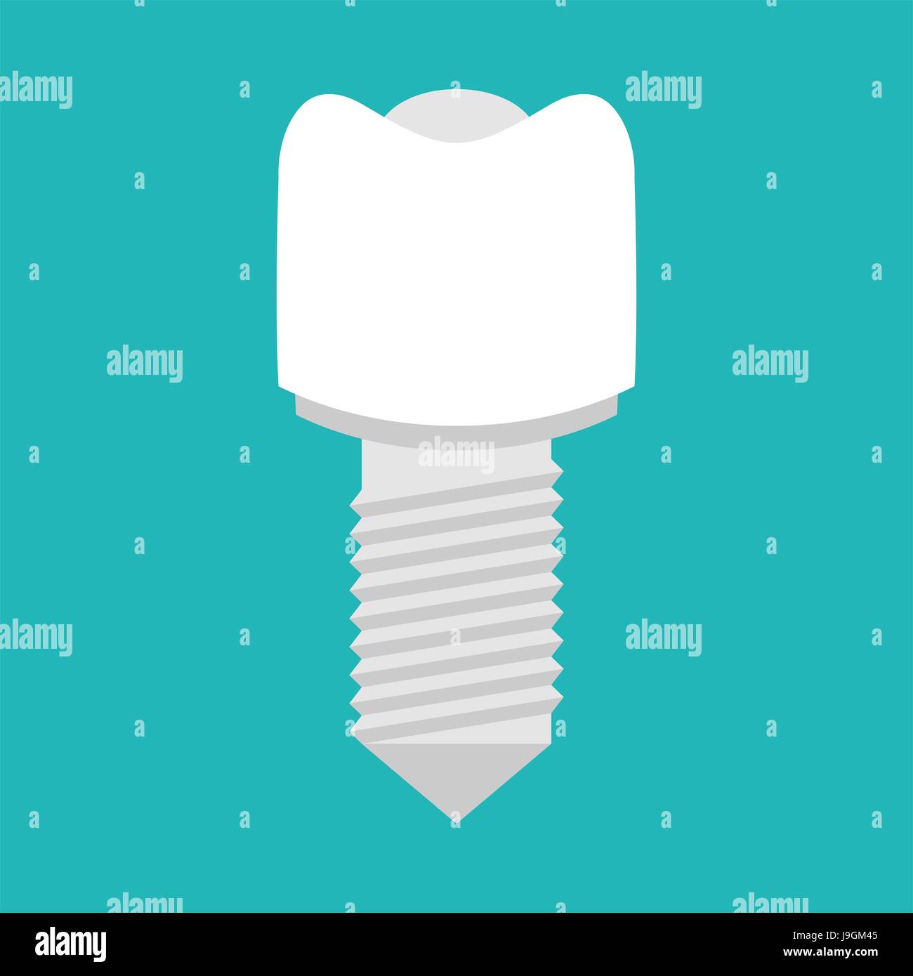 Implant with thread. Artificial tooth. Dentist illustration Stock ...