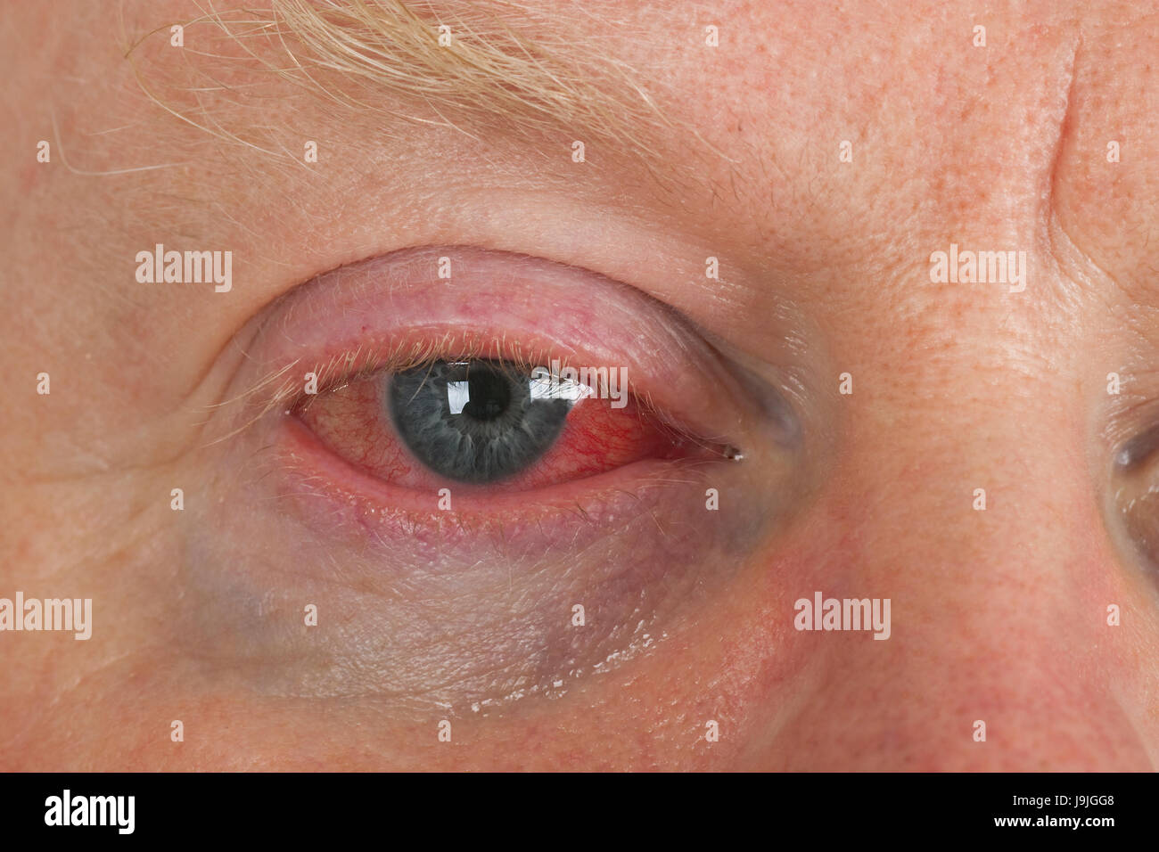 Close up shot from man's wrinkled tired irritated bloodshot eye Stock ...