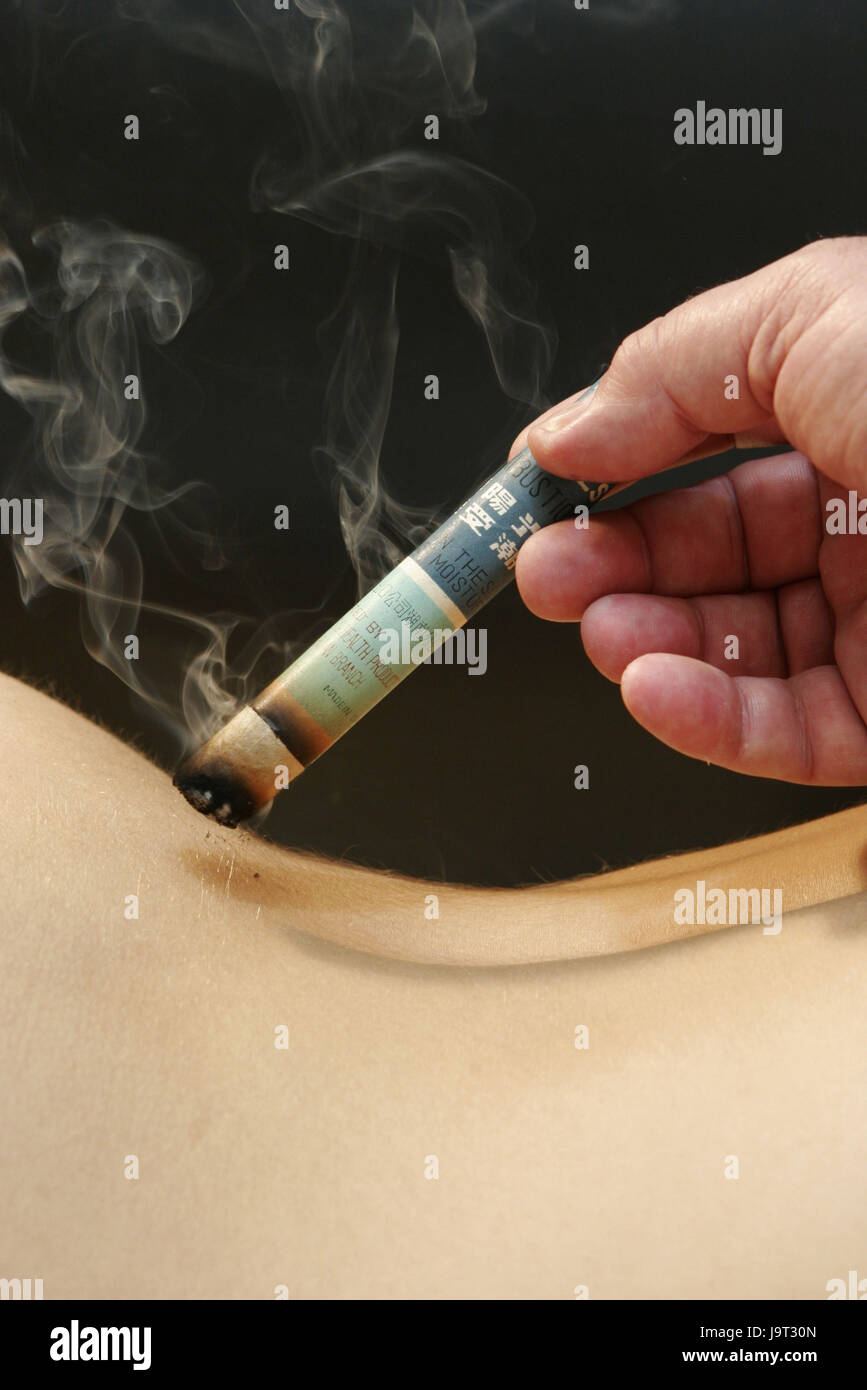 Moxibustion woman detail abdomen moxa hi-res stock photography and ...