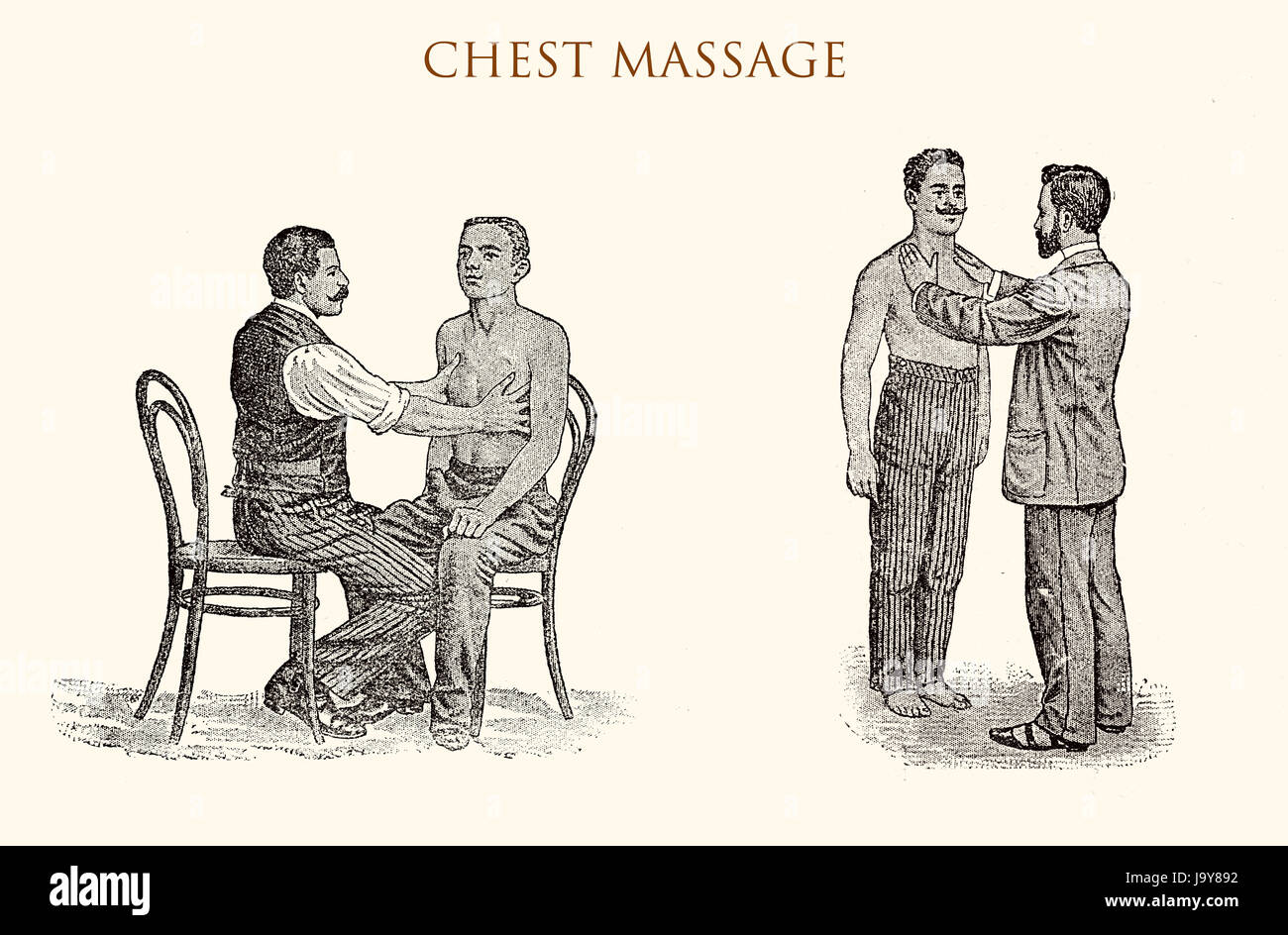 Chest massage, vintage illustration Stock Photo - Alamy