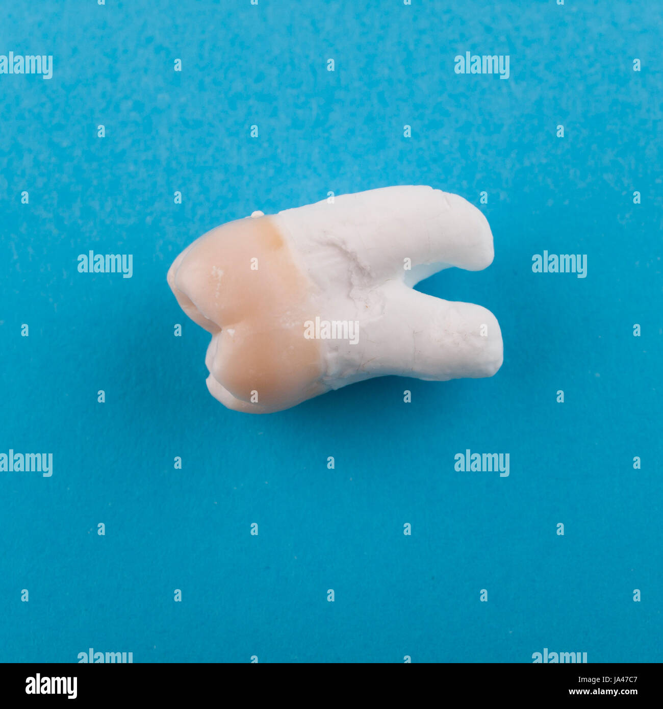 Third molar hi-res stock photography and images - Alamy