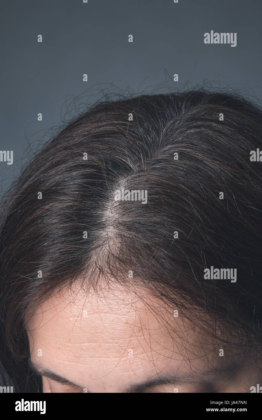 Root hair hi-res stock photography and images - Alamy