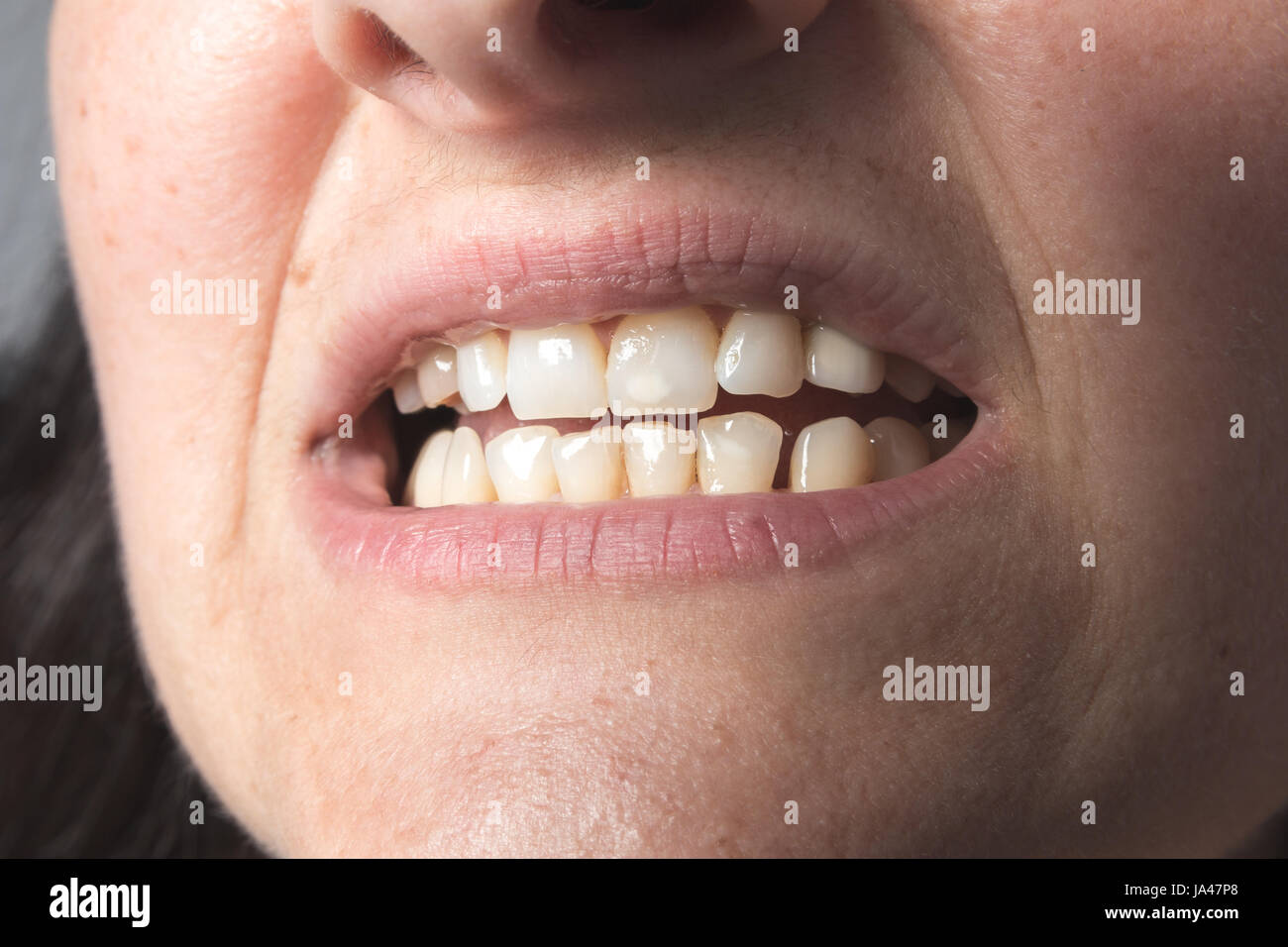 Healthy open mouth closeup teeth hi-res stock photography and images ...