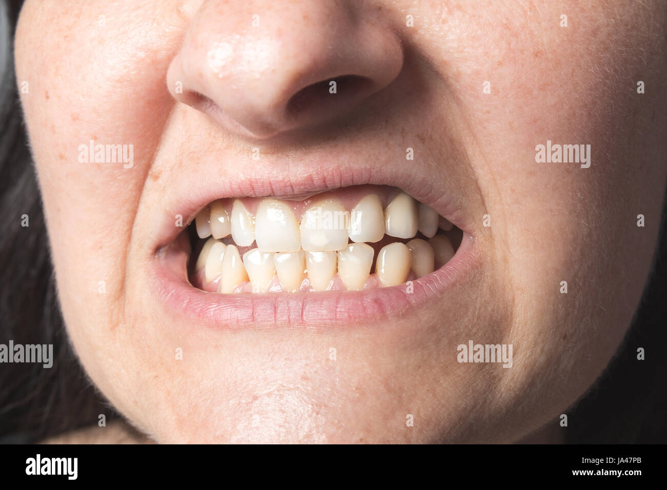 Teeths white hi-res stock photography and images - Alamy