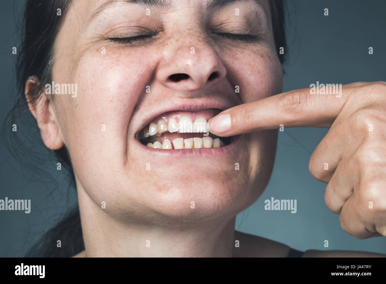Healthy open mouth closeup teeth hi-res stock photography and images ...