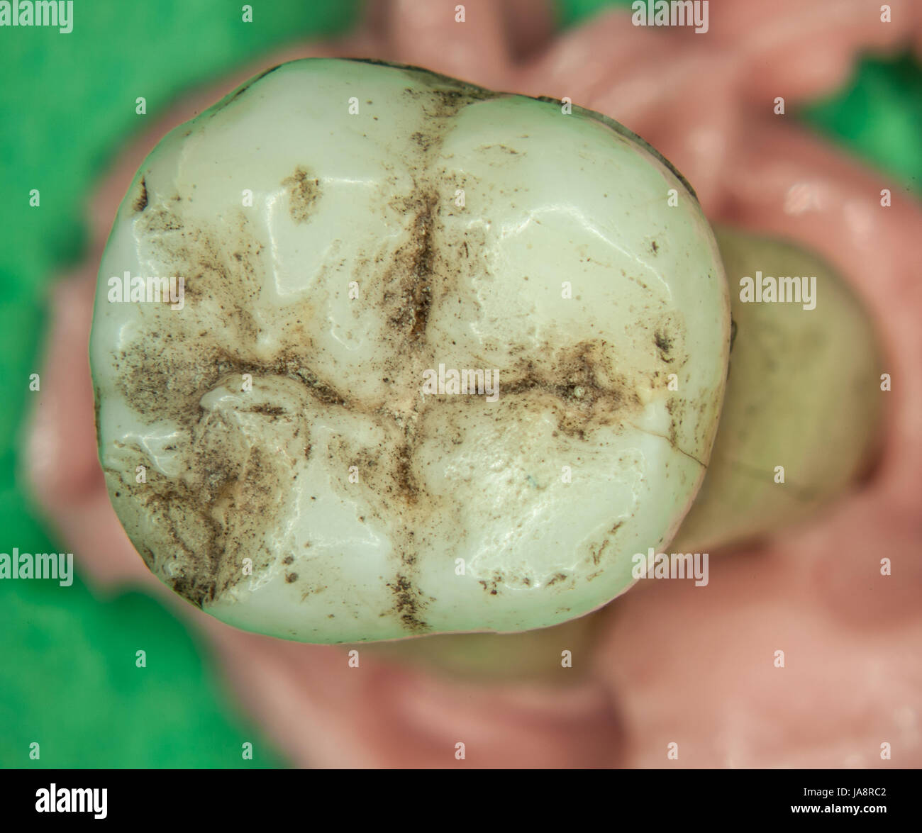 teeth, bit, pine, caries, molars, teeth, bit, pine, caries, molars ...