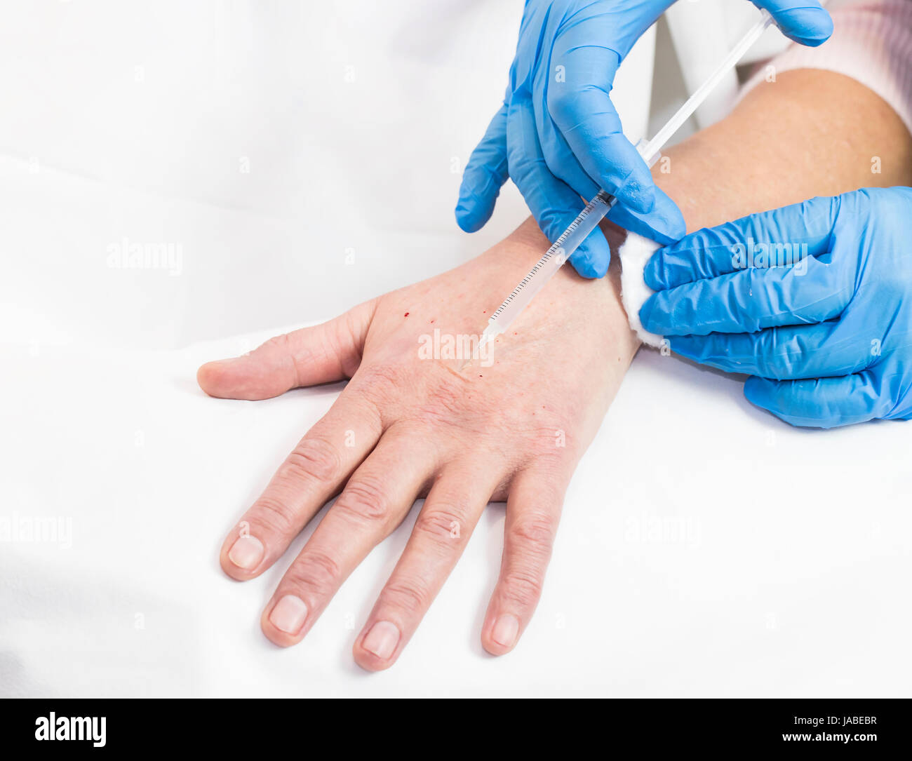Mesotherapy process on a female hand in clinic Stock Photo - Alamy